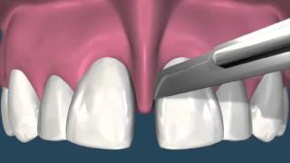 Chirurgie - Cabinet Dentaire Dr Imen Marzouki